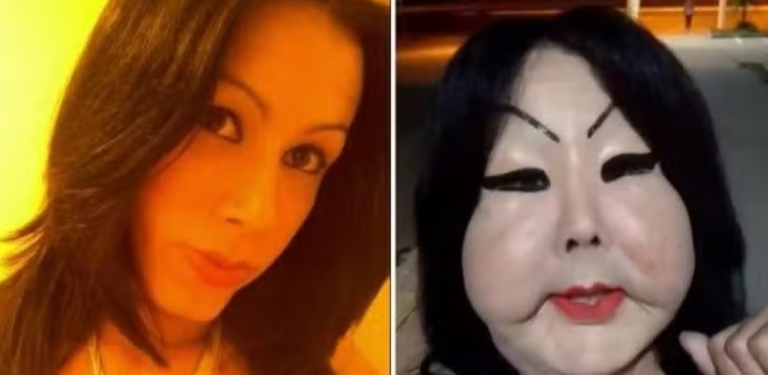 Juju do Pix: Confira o antes e depois do rosto da influenciadora - Diva ...